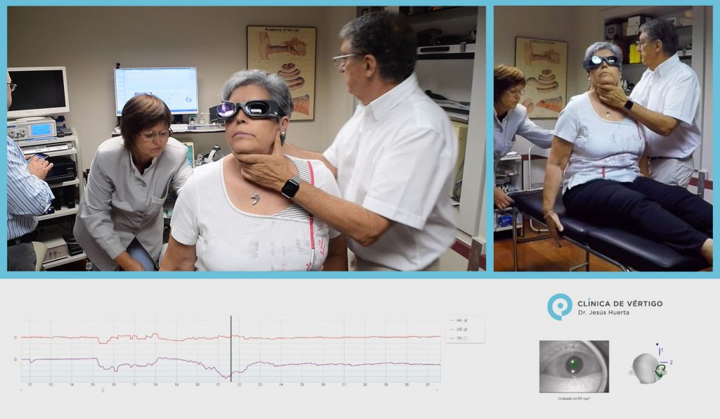 ¿Cómo Se Trata el Vértigo? - Clínica de Vértigo